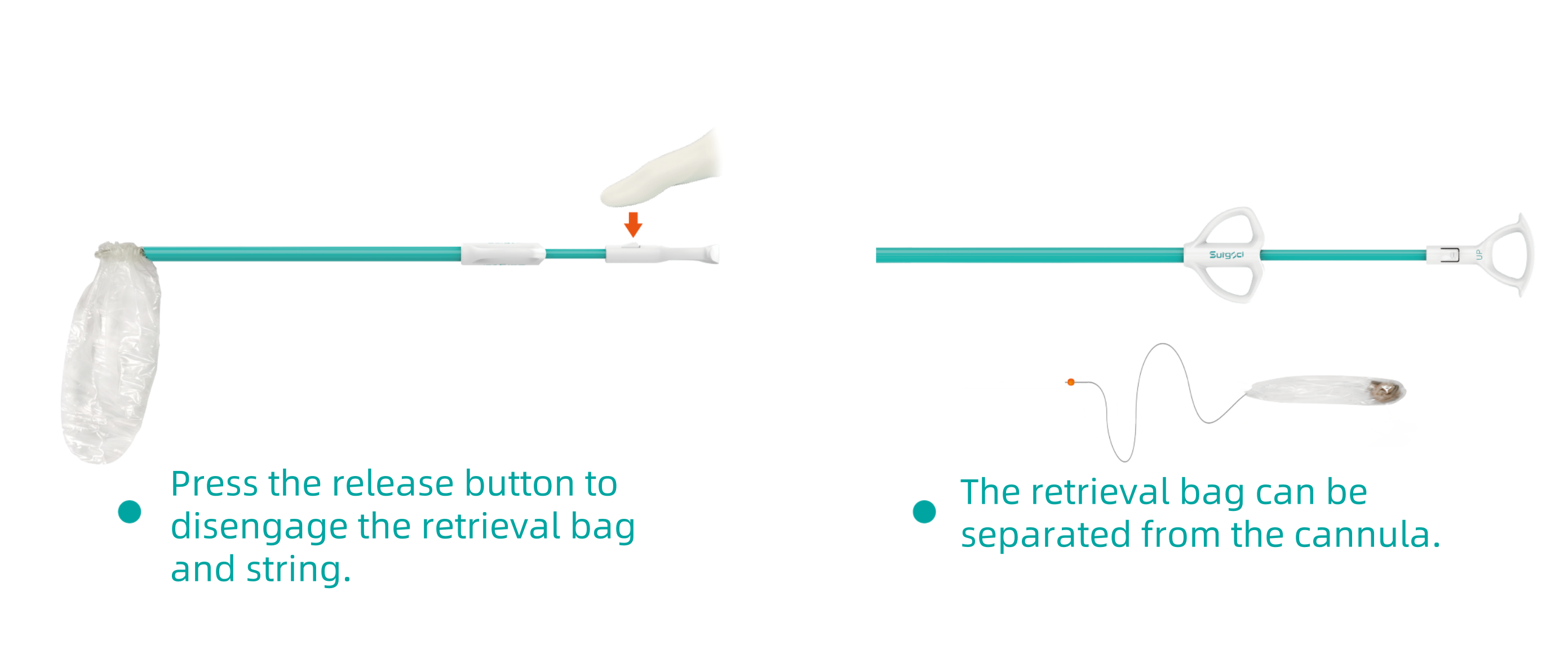 Introducing Surgsci Disposable Laparoscopic Specimen Retrieval Bags ...